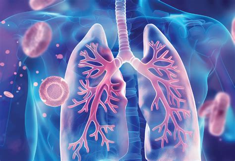 Understanding Pneumococcal Disease And The Role Of Vaccination