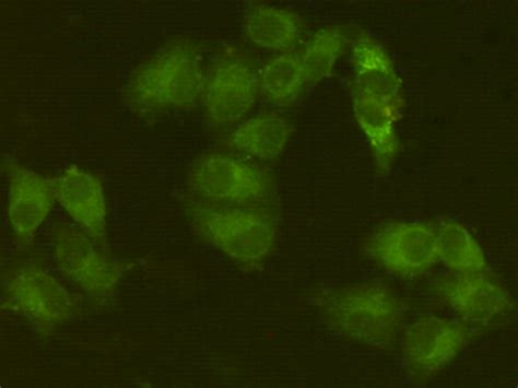 小鼠抗jak1单克隆抗体anti Jak1 Mouse Monoclonal Antibody 生命科学产品与技术服务 生工生物工程上海