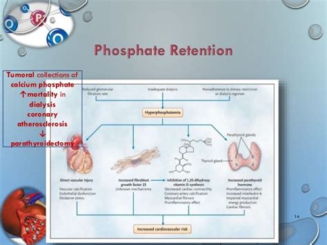 Hyperphosphatemia In Ckd