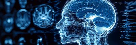 Intelligence Analyzing Medical Scans For Early Disease Detection And Diagnosis Ai Powered