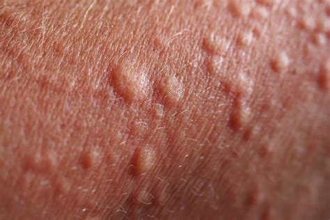 Bumps On Skin Skin Mysteries Explained Reader S Digest