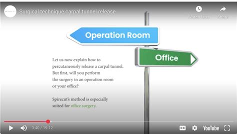 Spirecut Treat Carpal Tunnel Syndrome And Trigger Finger