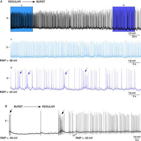 Dynamic Switch Between A Regular And A Bursting Spiking Pattern In A Download Scientific