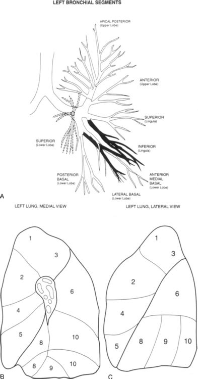 Thoracic Radiology Imaging Methods Radiographic Signs And Diagnosis