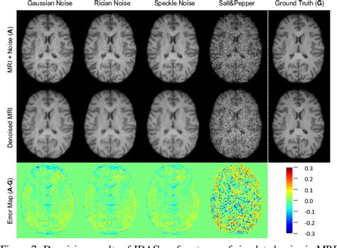 Figure 7 From Iterative Learning For Joint Image Denoising And Motion