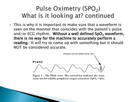 Pulse Oximetry Waveform Interpretation At Harrison Grove Blog