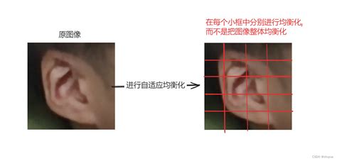 自适应均衡化图片 Csdn博客