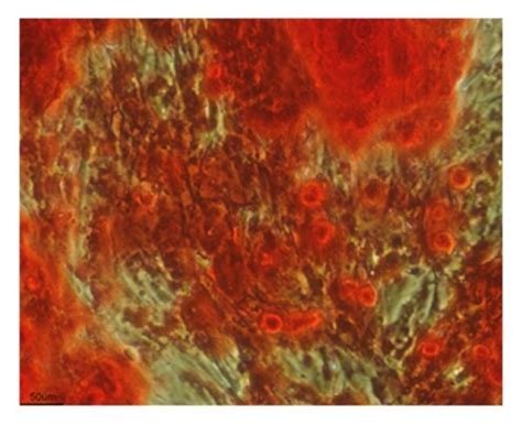 Ascs Differentiation To Adipocyte From Ipfp A And Sc B Which