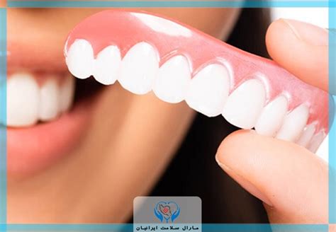 بهترین دندان مصنوعی برای افراد جوان کلینیک مارال سلامت ایرانیان