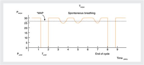 Shapes Of The Aprv Wave With Spontaneous Breathing Unlike Other Mv
