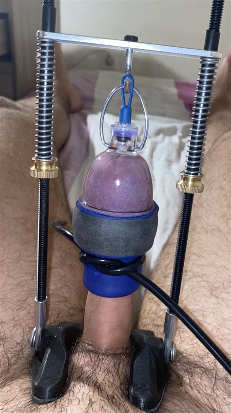 Is This Setup Safe R Gettingbigger