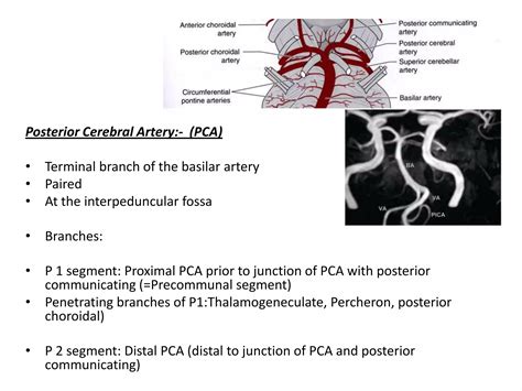 Posterior Circulation Stroke Syndromes Pptx