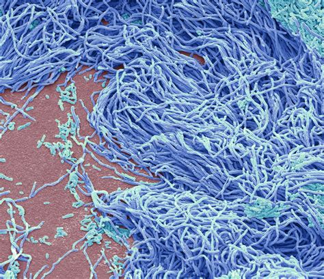Faecal Bacteria Sem Stock Image F042 2518 Science Photo Library