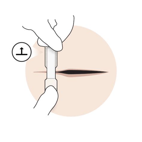 How Interlock Works Suturegard