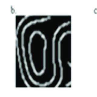 Result Of Thermal Segmentation With The Canny Method A Normal Breasts Download Scientific