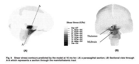 Progress Reports Finite Element Model Of The Brain Vanderbilt University