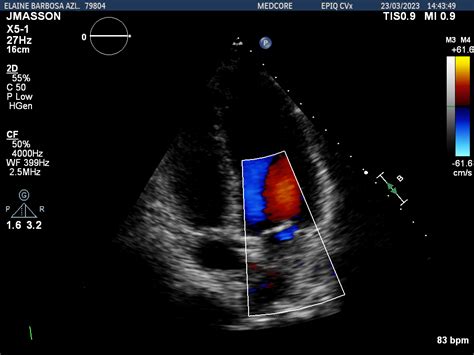 Rm Model Instance Segmentation Dataset By Vilson Soares De Siqueira