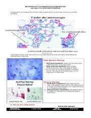 Lab 8 ACID FAST STAINING Docx MICROBIOLOGY And PARASITOLOGYLABORATORY Lab Report 8 ACID FAST