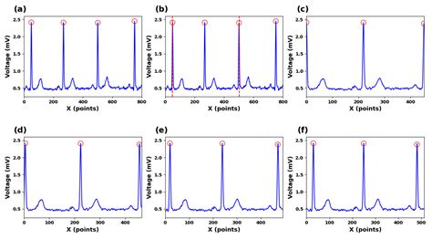 Electrocardiogram Based Biometric Identification Using Mixed Feature