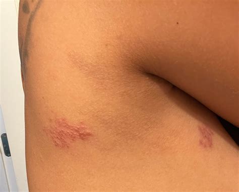 Smaller Patch Started Last Wed 1019 Second Larger Patch Started Friday I Believe 1021