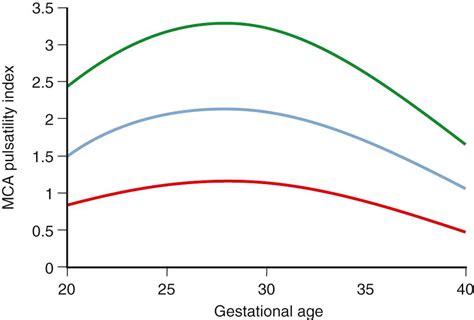 Fetal Growth Restriction Clinical Tree