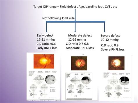 Classification And Management Of Glaucomapptx