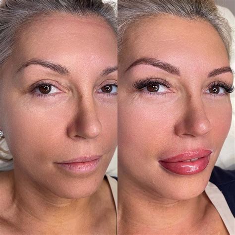 Permanent Makeup Before And After