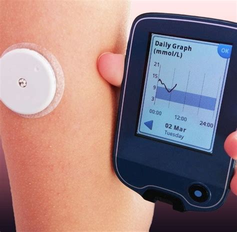 Cgm Devices Sensors And Diabetes Supplies Through Medicare Aeroflow Diabetes