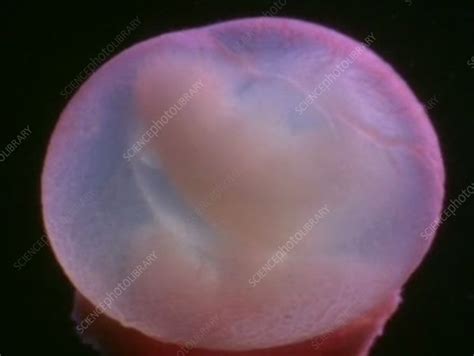 Rat Embryo In Capsule Light Microscopy Stock Video Clip K005 7932 Science Photo Library