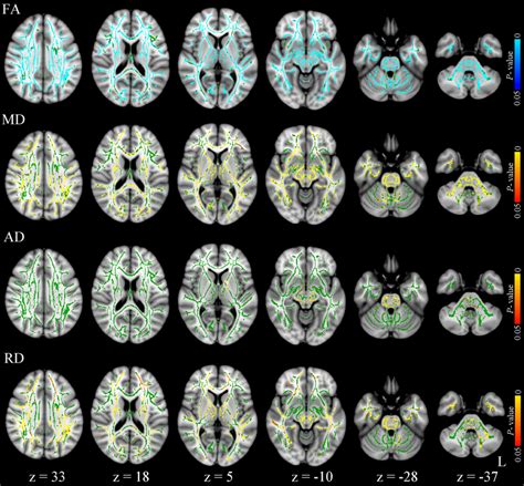 Statistical Maps Showing Significant P Download Scientific Diagram
