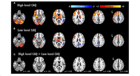 Brain Activation Maps Of Alternative Uses Task Aut We Presented Download Scientific