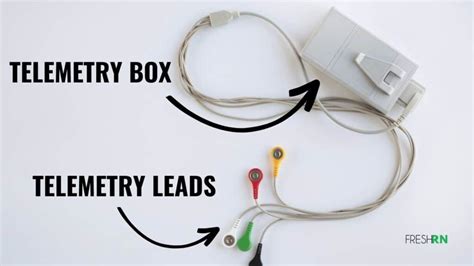Telemetry Monitoring Lead Placement