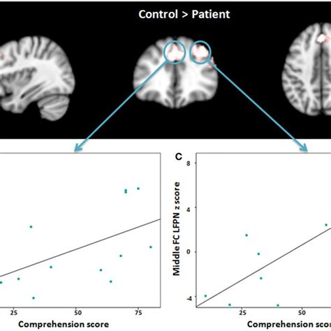 The Left Frontoparietal Network Regions Download Table