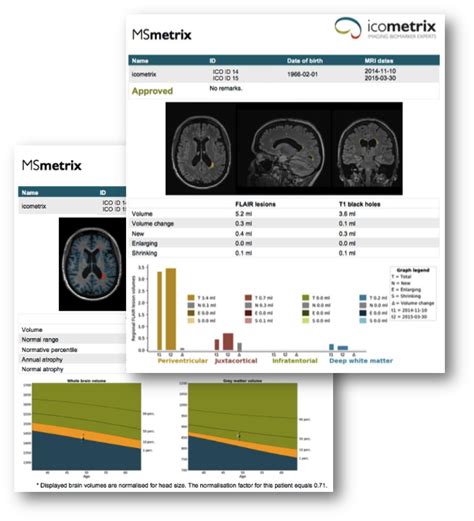 Icometrix On Linkedin Msbase And Icometrix Have Joined Efforts In A Large Scale Project To
