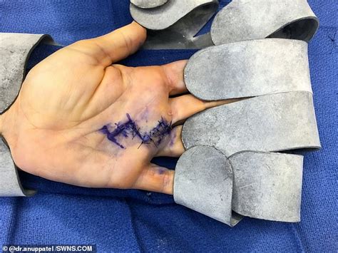 The Ultimate Millennial Accident Fitness Instructor Cuts Hand While
