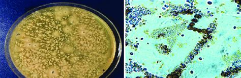 Aureobasidium Melanogenum A Colonies On Malt Extract Agar 2 Days