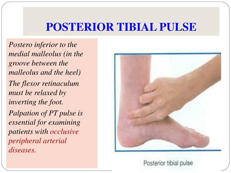 Posterior Tibial Artery Palpation