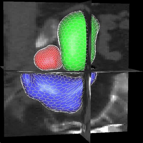 Figure 1 1 From Segmentation Of Anatomical Structures Of The Lower
