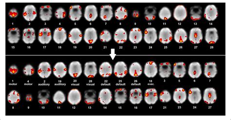 figure 1 from classification and extraction of resting state networks