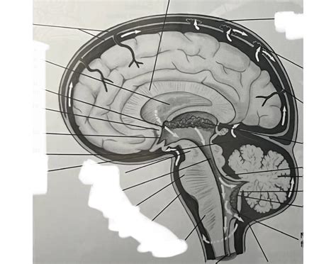 Sagittarius View Of Choroid Plexus And Flow Of Csf Quiz