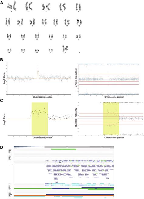 Example Of A Comparison Of The Resolution Of Karyotyping By G Banding