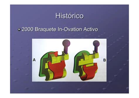 Self Ligating Brackets Pdf