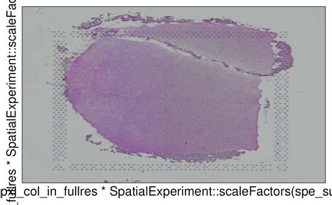 A Ggplot2 Layer For Visualizing The Visium Histology — Geomspatial • Spatiallibd
