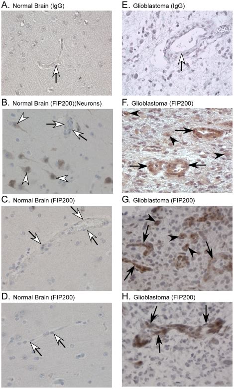 Formalin Fixed And Paraffin Embedded Sections Of Surgical Biopsies Of