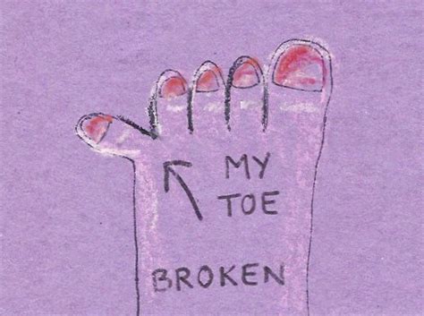 Story Of The Broken Toe The Road To There
