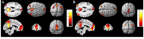 Global Patterns Of Default Mode Network Functional Connectivity At Rest