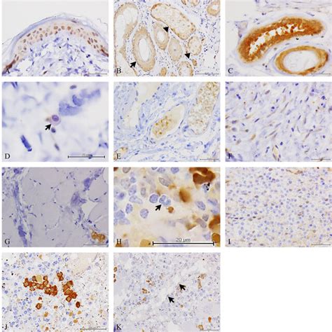The Staining Properties Of Peroxiredoxin Prdx 1 And 2 In The Newly