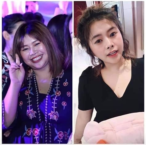 น้ำ ห นั ก ล ง ไ ม่ เ ย อ ะ แต่ สั ด ฟื่นฟูและดูแลสุขภาพ