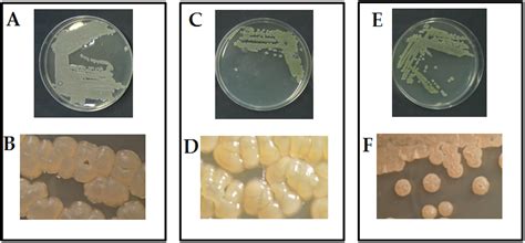 Chemical Identification Of Secondary Metabolites From Rhizospheric