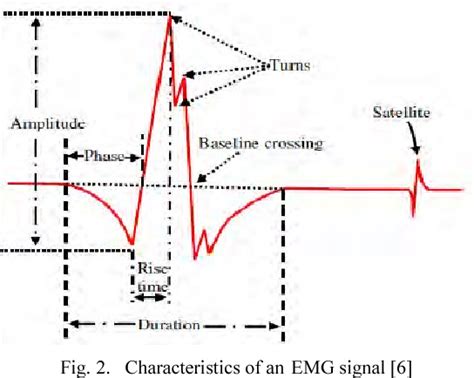 Figure 2 From Towards Design And Implementation Of A Low Cost EMG Signal Recorder For